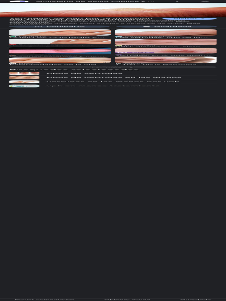 VPH en Manos Se Contagia - Buscar Con Google | PDF