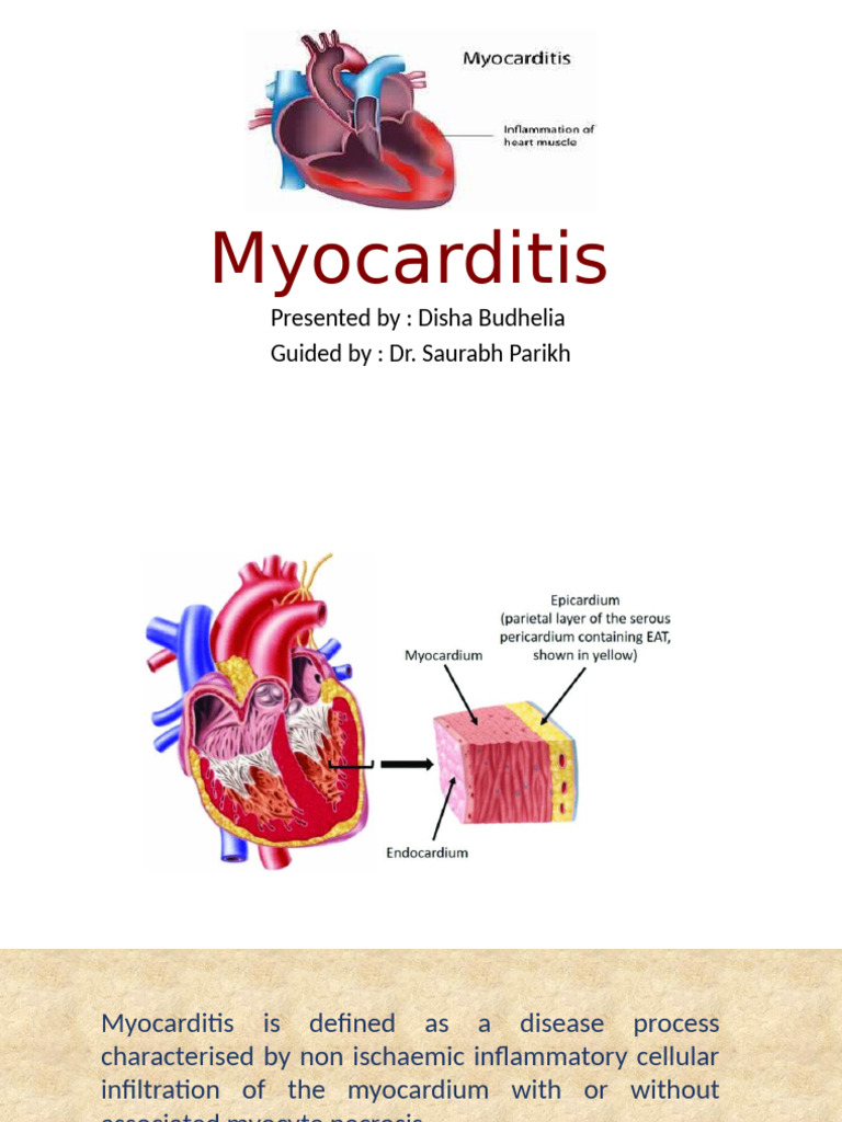 Myocarditis Disha PG 1 | PDF | Myocardial Infarction | Heart