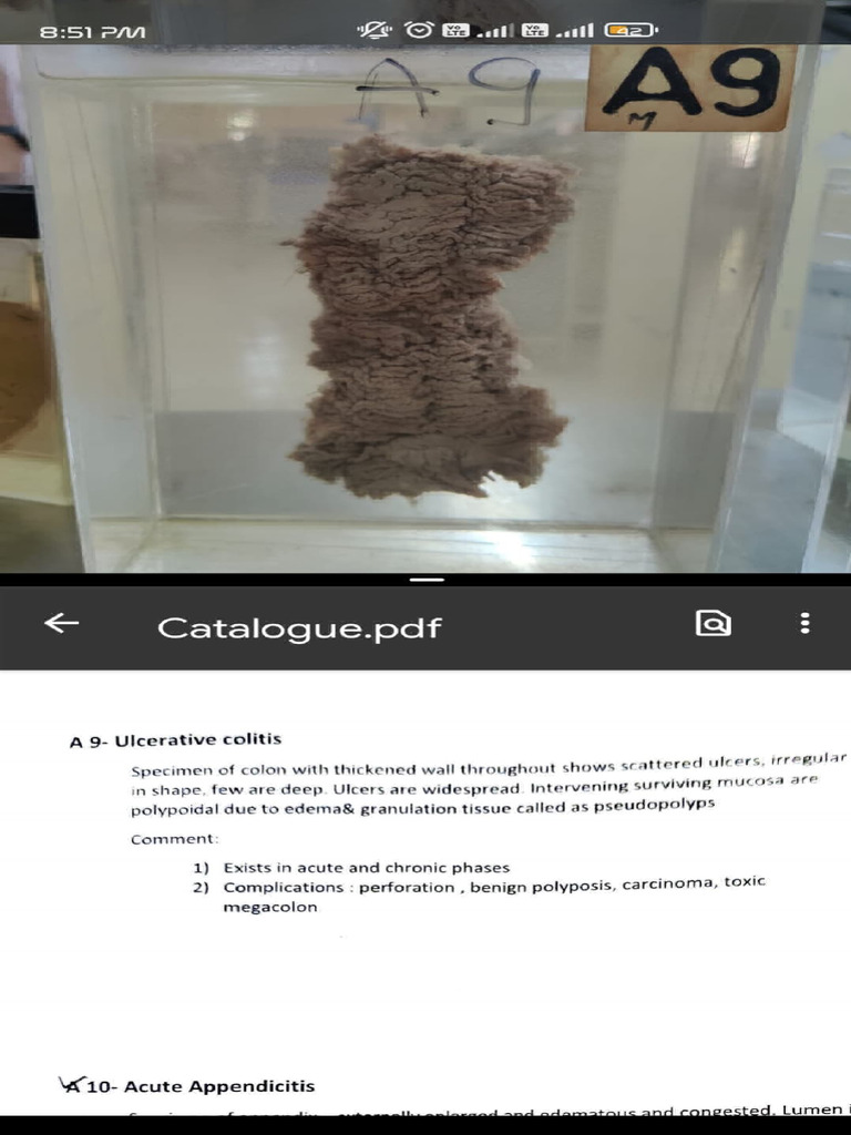 Surgery Specimens Exam-1 | PDF | Neoplasms | Testicle