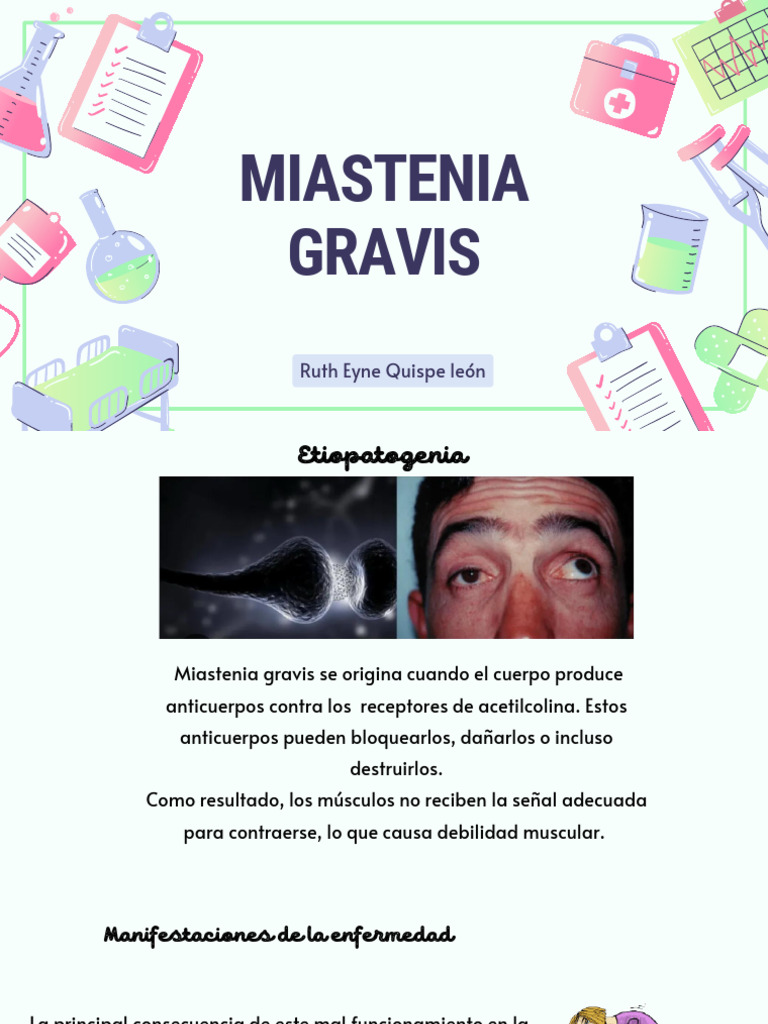 Miastenia Gravis: Etiología y Diagnóstico | PDF | Elisa ...
