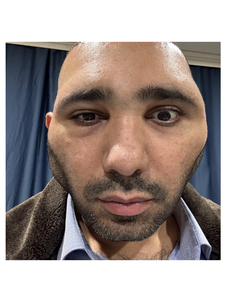 Monsieur NASIR Accident | PDF