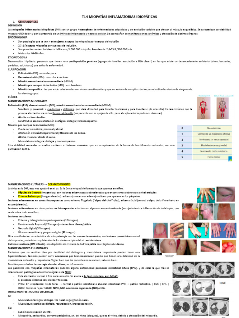 t14 Miopatías Inflamatorias Idiopáticas | PDF | Medicina | Medicina CLINICA