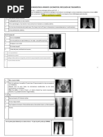 Osteofitos y su Impacto Clínico | PDF | Hueso | Sistema musculoesquelético