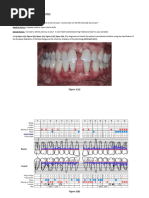 Bite-Wing Radiography Technique Guide | PDF