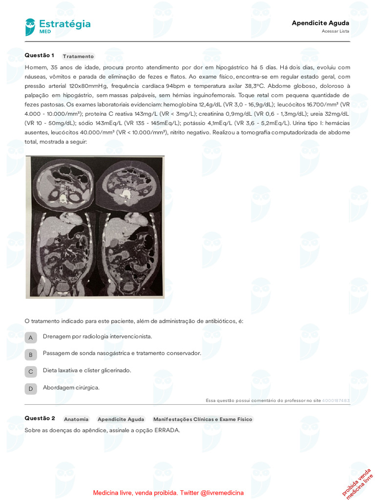 Apendicite Aguda - 1 | PDF | Dor | Sintomas e sinais