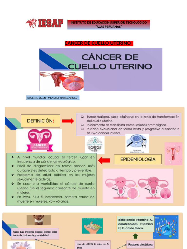 Cancer de Cuello Uterino | PDF