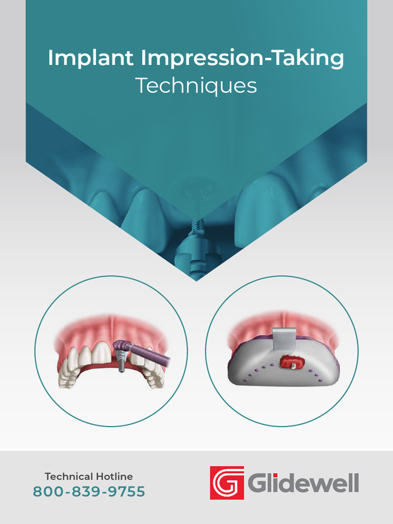 Implant Impression-Taking Techniques | PDF | Dental Implant | Dentistry Branches