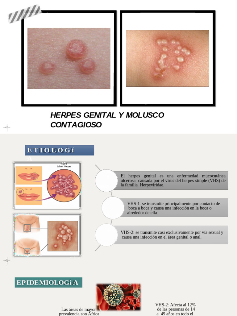 Clase Herpes y Molusco Contagioso | PDF | Virus | Inmunología