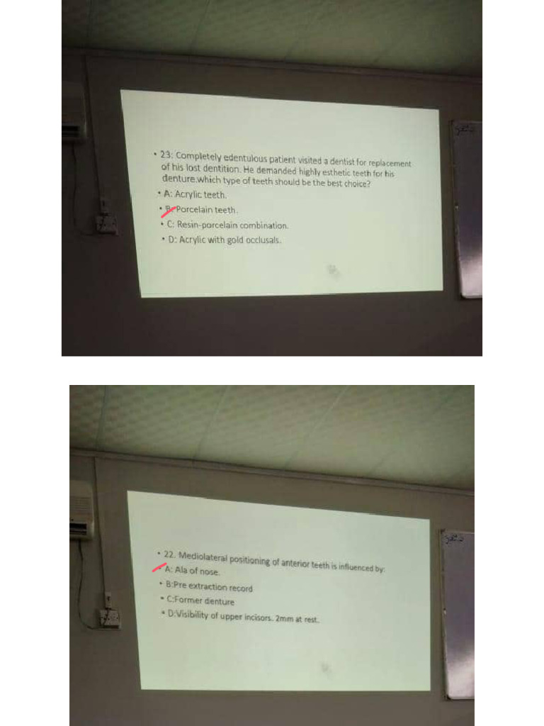 Prostho Module | PDF