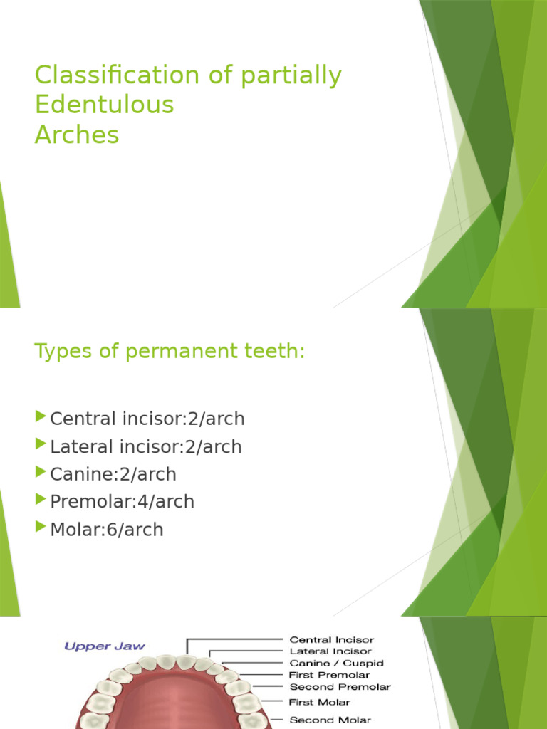 Classification of Patially Edentulous Arches | PDF