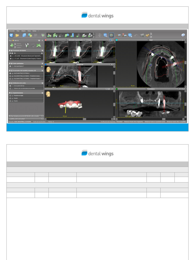 Protocolo - Ruiz Martã - Nez, Esteban - Ioi 1.6 | PDF | Software | Ingeniería Informática