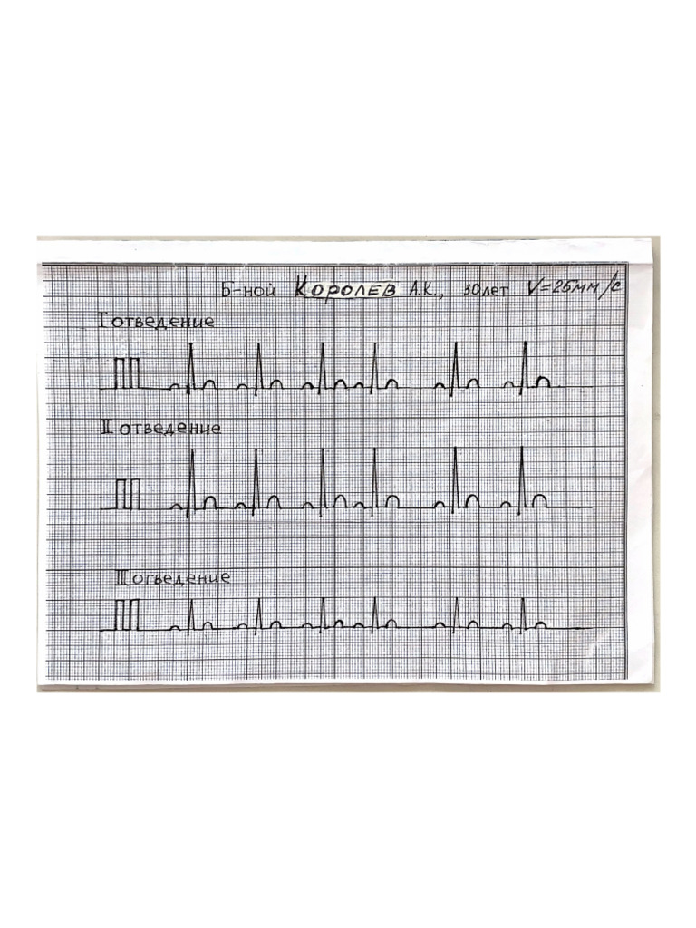 Ecg 11. | PDF