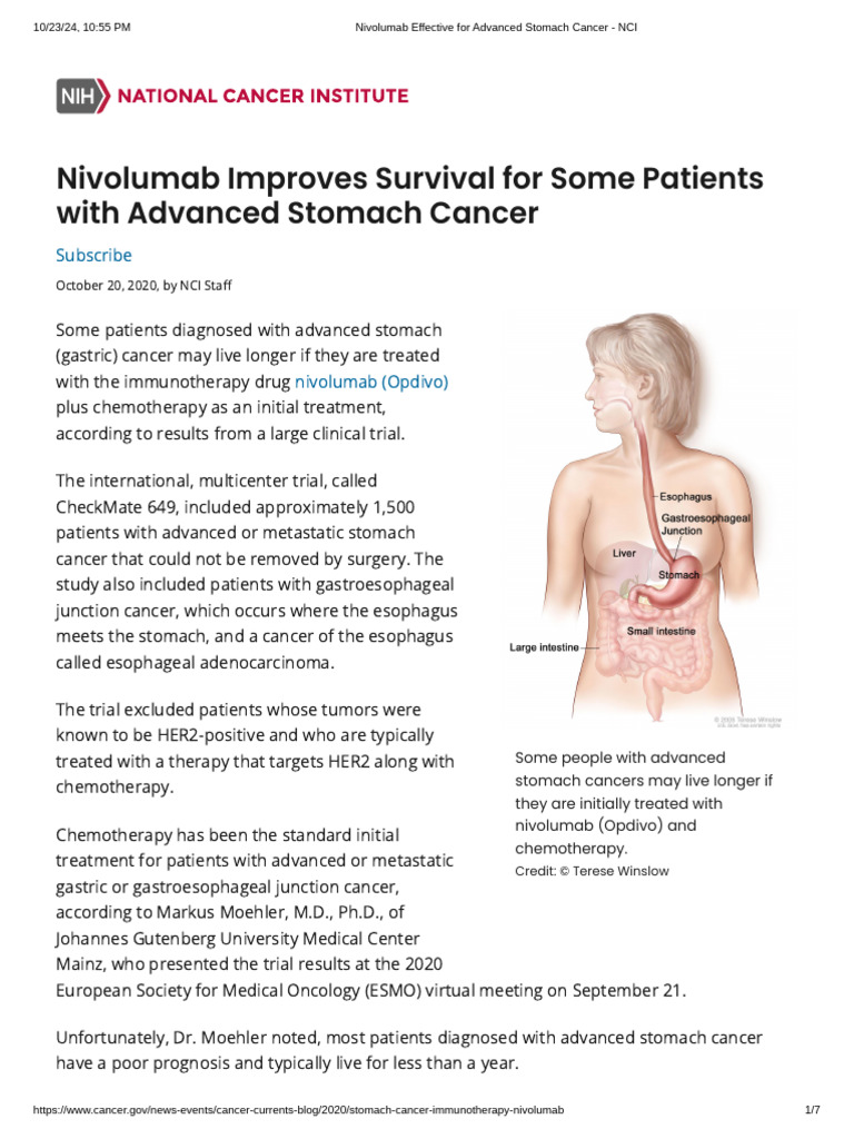 Nivolumab Effective For Advanced Stomach Cancer - NCI | PDF | Cancer ...