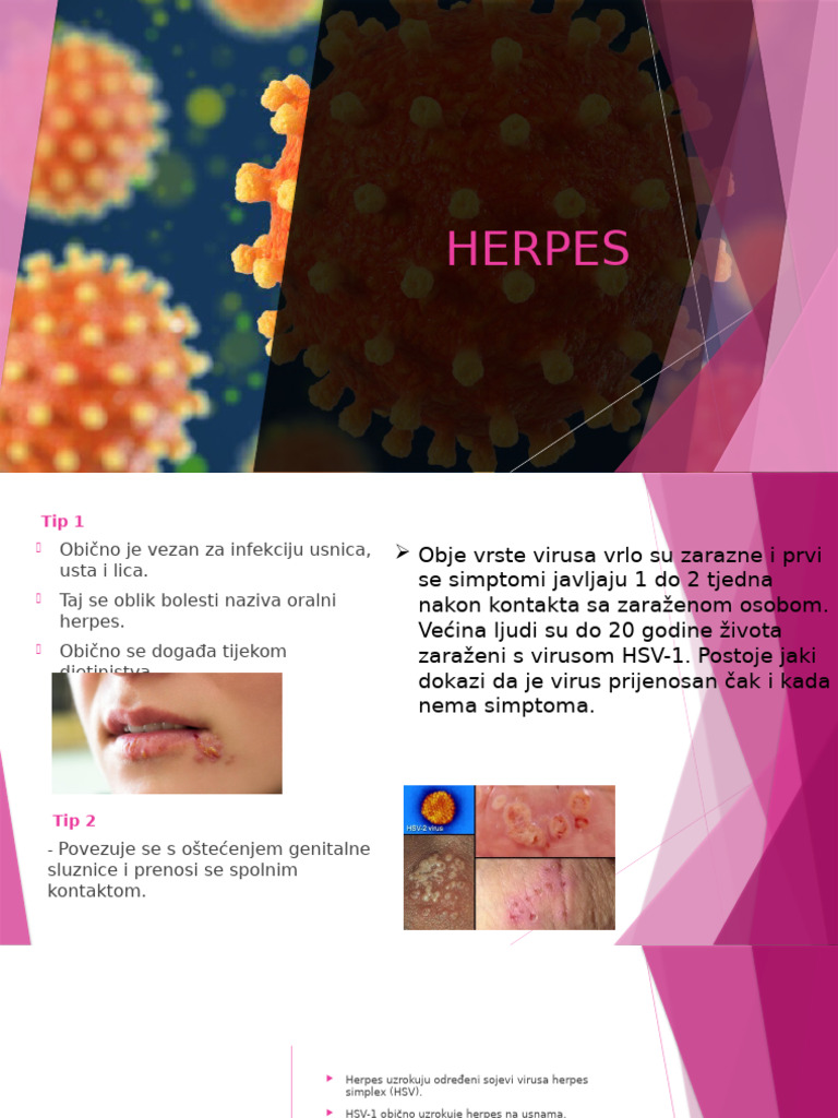 Herpes | PDF