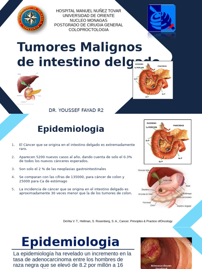 TUMORES MALIGNOS DE DUODENO 2 | PDF | Intestino delgado | Cáncer