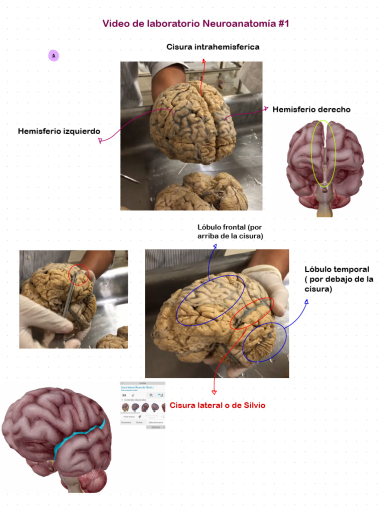 Neuroanatomia identificación de partes | PDF | Lóbulo temporal ...