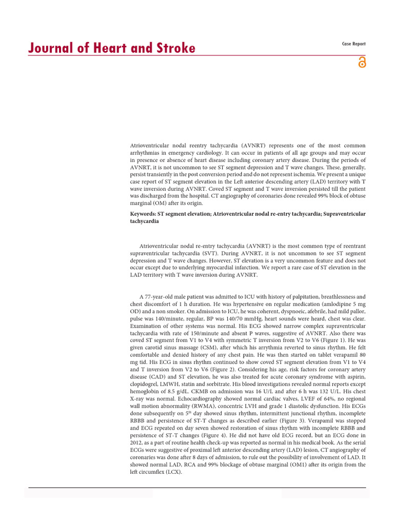 ST Segment Elevation During Supraventricular Tachycardia SVT An Enigma ...