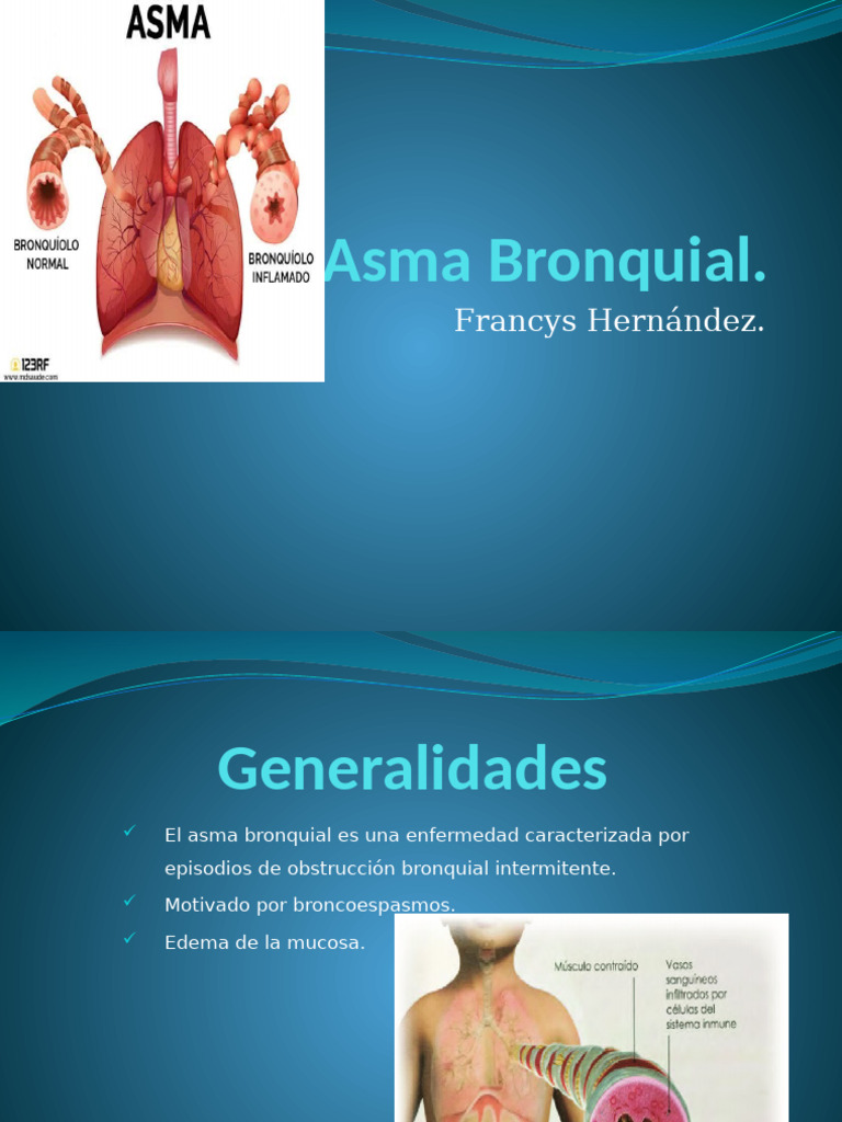Asma Bronquial | PDF | Asma | Enfermedades respiratorias