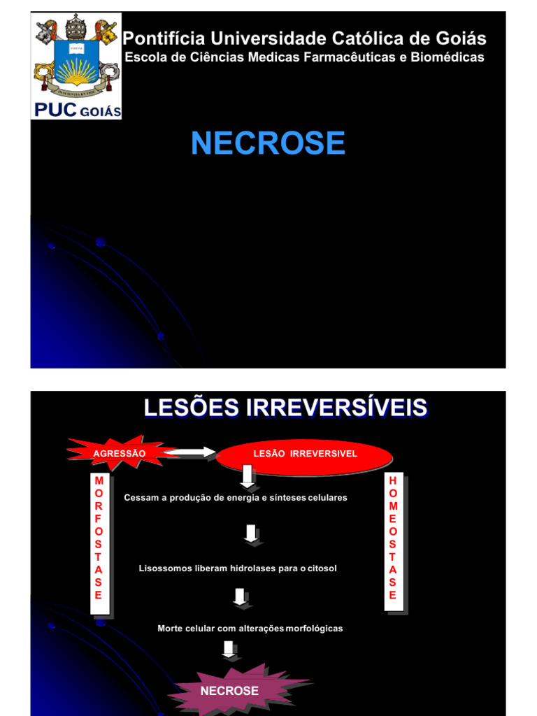 Tipos e Causas da Necrose Celular | PDF | Necrose | Especialidades médicas