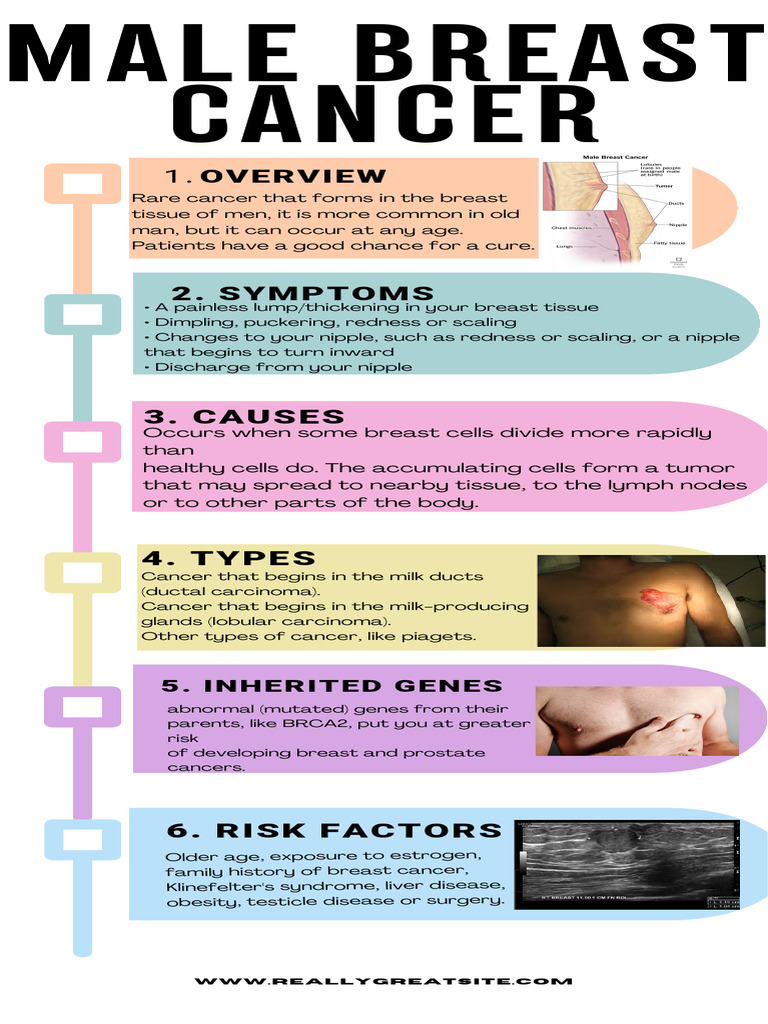 Male Breast Cancer Overview | PDF