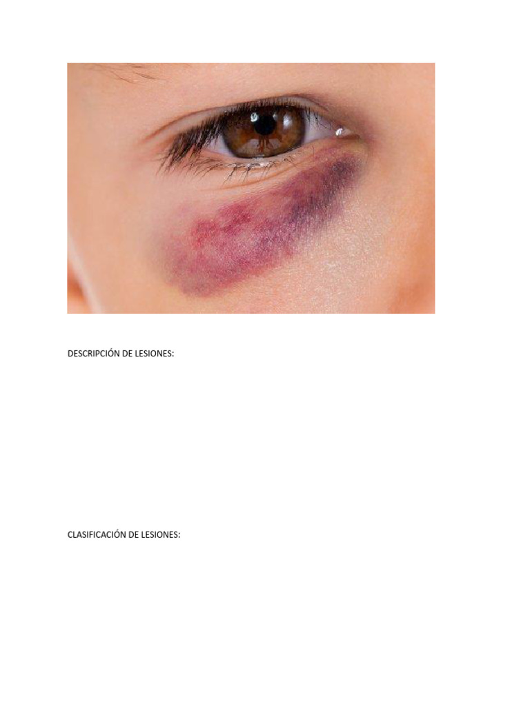 Clasificación y Descripción de Lesiones | PDF