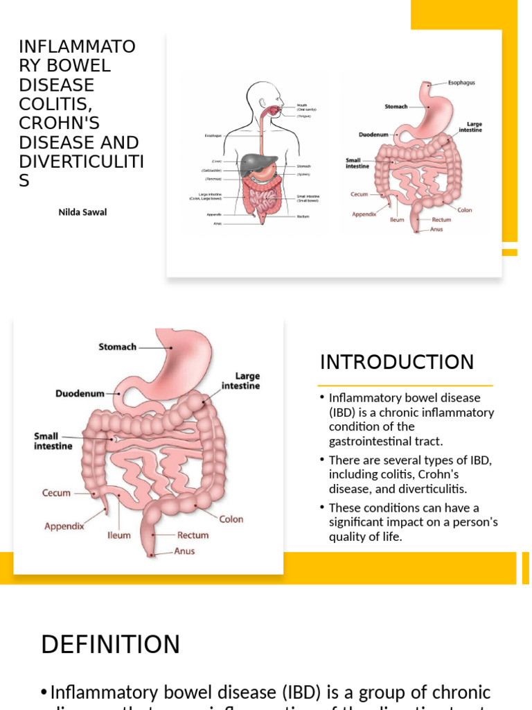 Inflammatory Bowel Disease Colitis J Crohn's Disease and | PDF ...