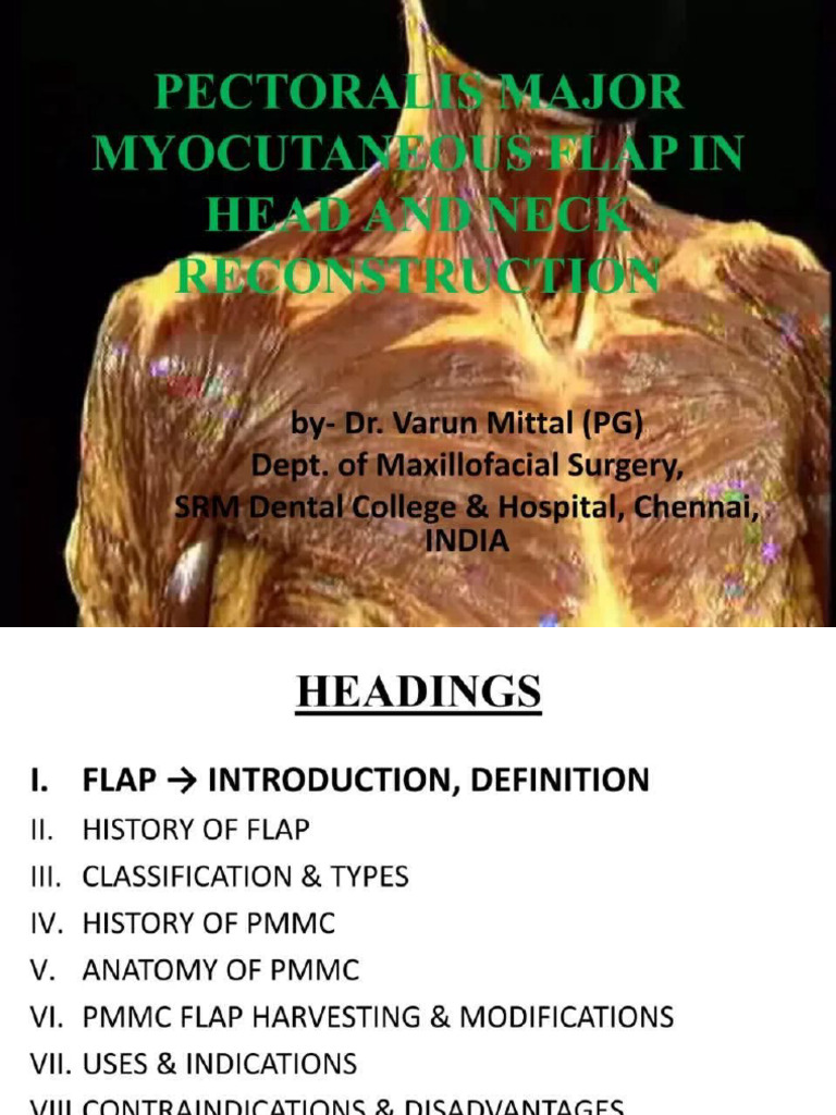 Pectoralis Major Myocutaneous Flap in Head and Neck Reconstruction | PDF