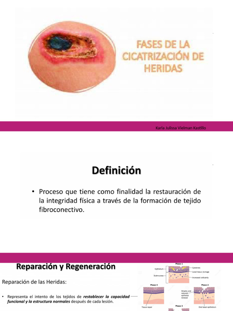 Presentación CICATRIZACION 1 CIRU | PDF