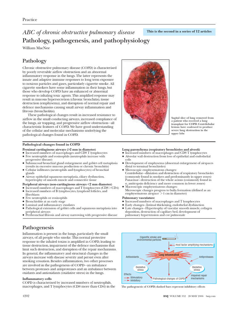 Understanding COPD: Pathology & Mechanisms | PDF | Lung | Chronic ...