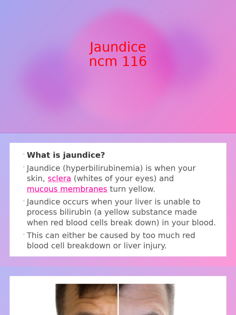 Jaundice | PDF | Liver | Medical Specialties