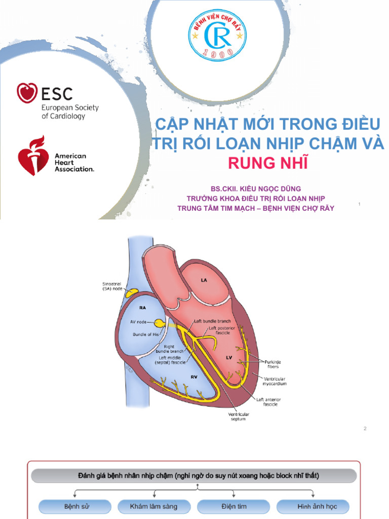 Kieu Ngoc Dung - Cap Nhat Rung Nhi Va Roi Loan Nhip Cham | PDF