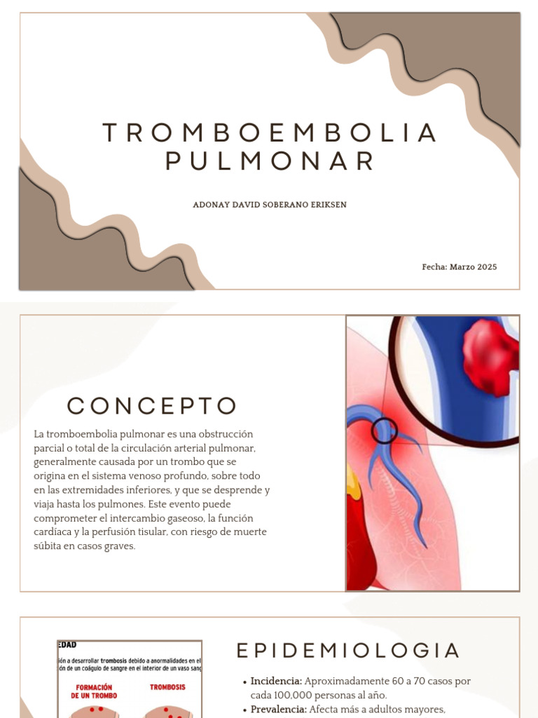 TROMBOEMBOLIA PULMONAR | PDF | Trombo | Especialidades Medicas