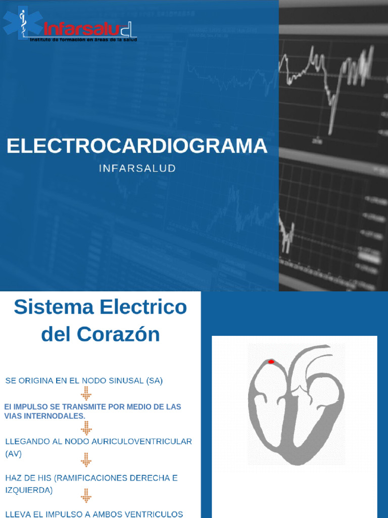 Electrocardiografía Lista | PDF