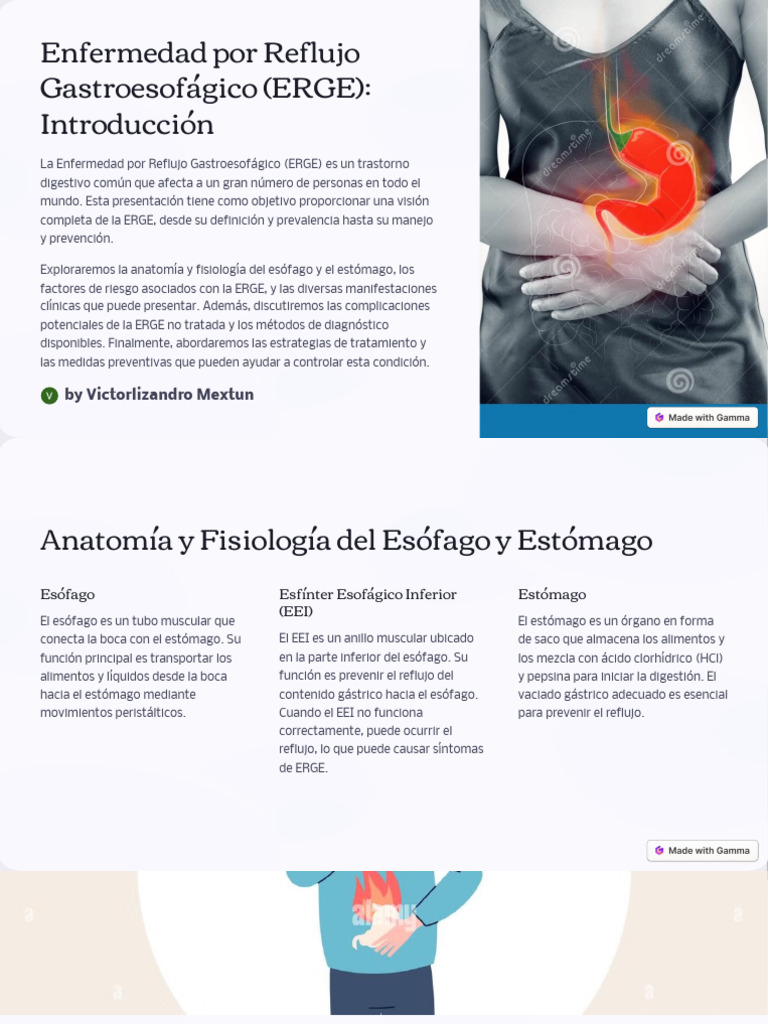Enfermedad Por Reflujo Gastroesofagico ERGE Introduccion | PDF | La enfermedad por reflujo ...