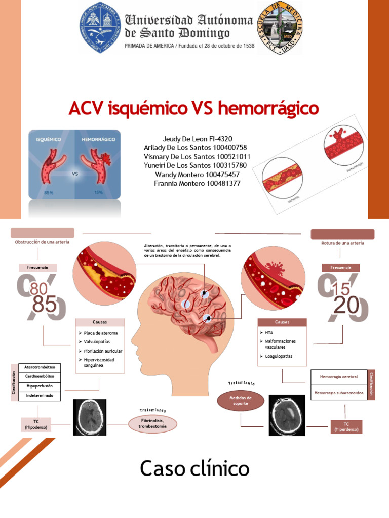 Acv Isquemico Vs Hemorragico | PDF | Carrera | Isquemia
