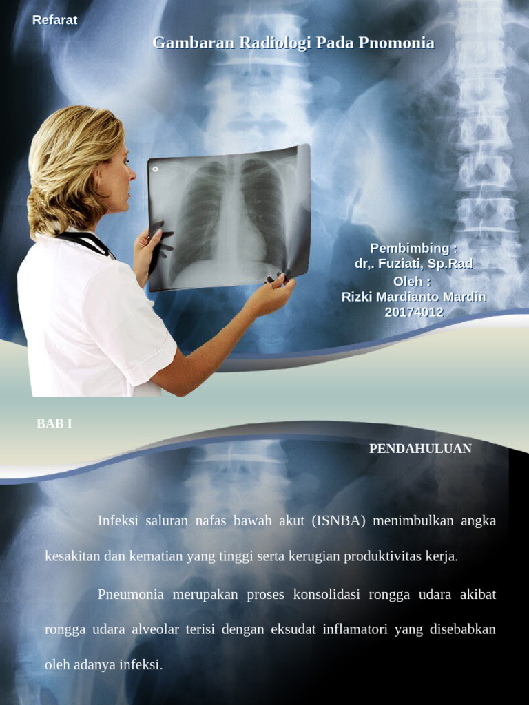 PPT Gambaran Radiologi Pnomonia | PDF