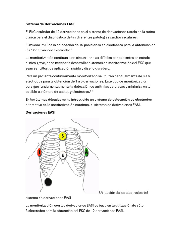 Ventajas del Sistema EASI en EKG | PDF | Enfermedades y trastornos ...