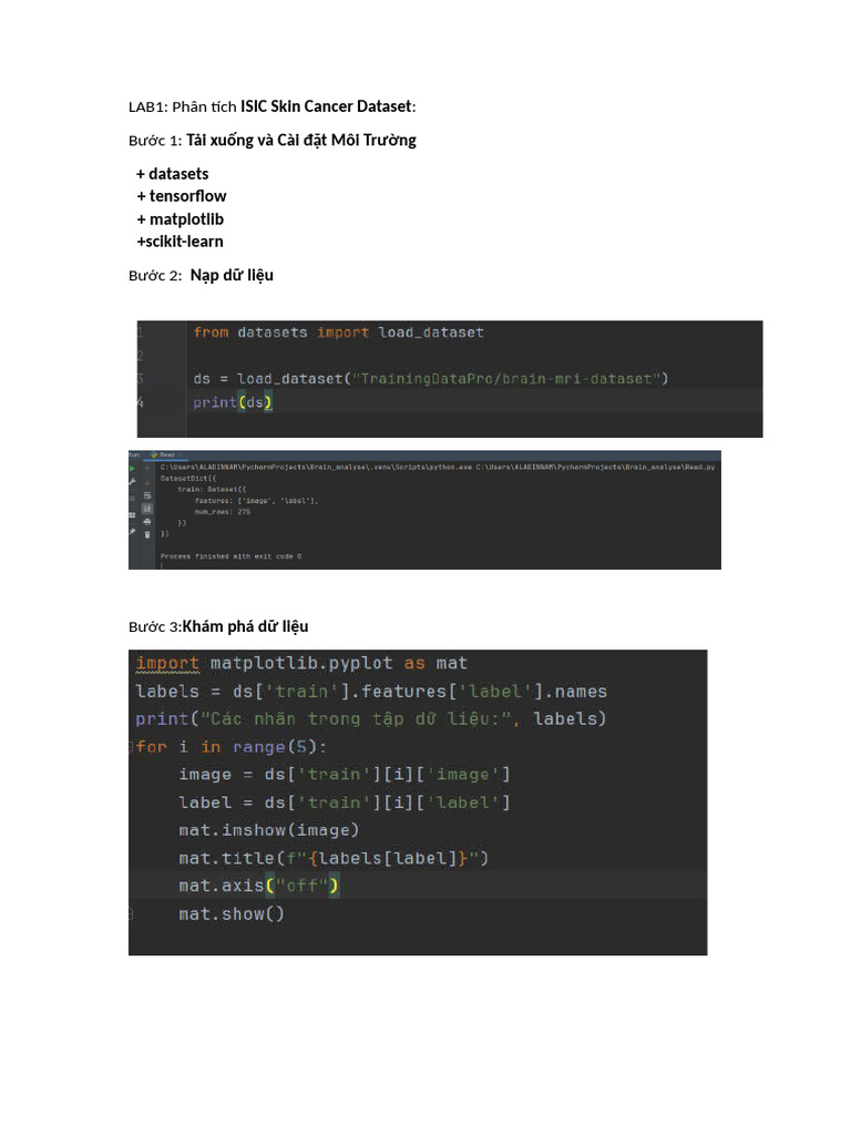 LAB1 Brain | PDF