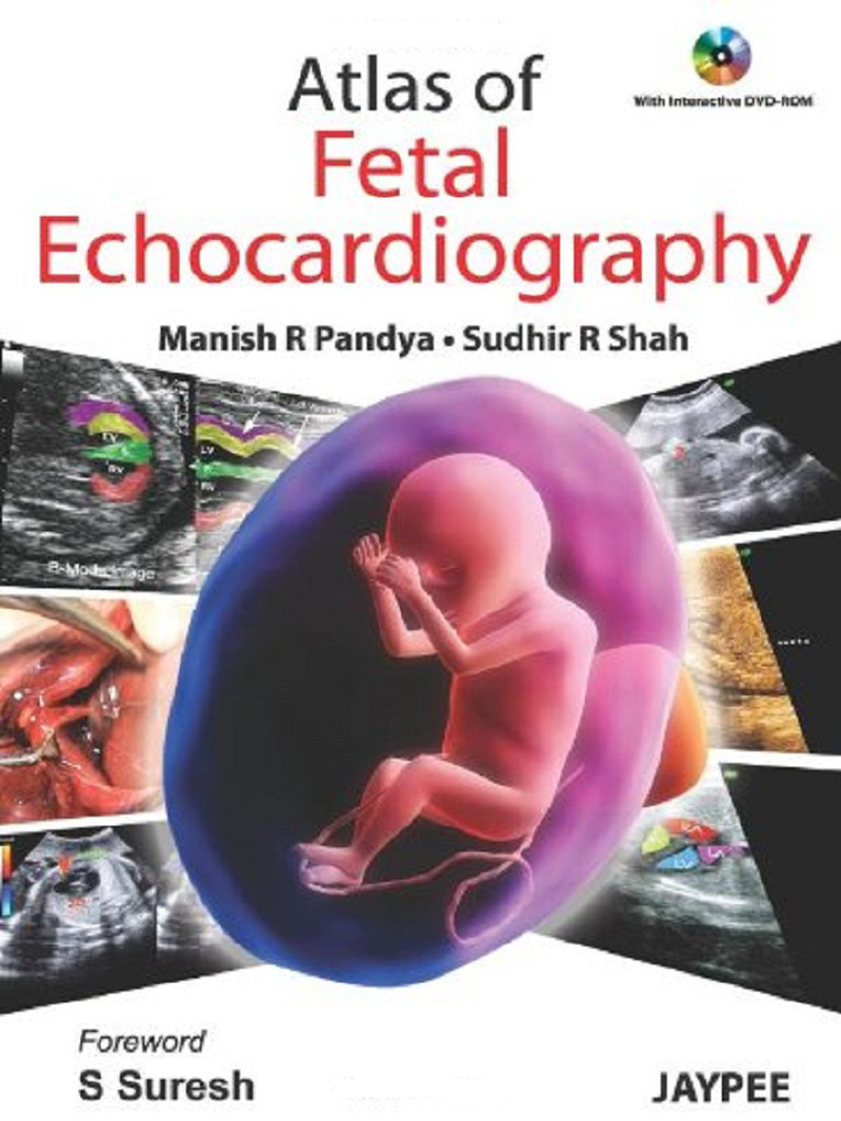 Atlas of Fetal Echocardiography, Manish R Pandya, Jaypee Bros | PDF ...