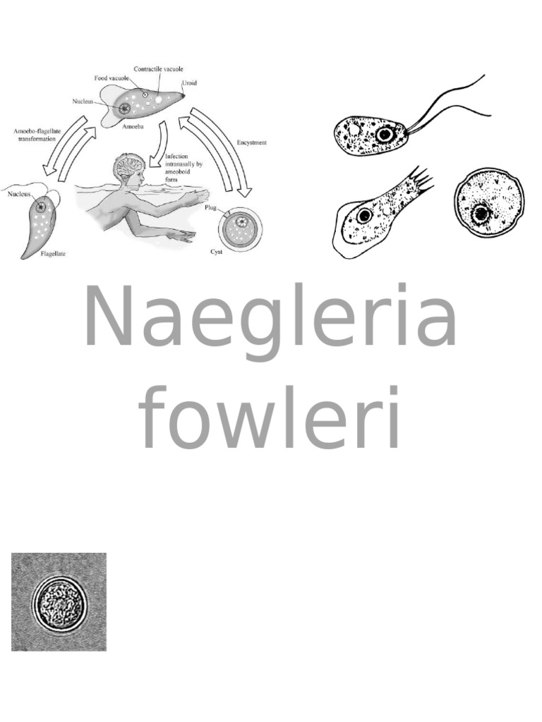 Naegleria fowleri: Riesgos y Síntomas | PDF | Enfermedades y trastornos ...