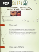 ZONA DE TRANFORMACION EN COLPOSCOPIA - Dra. Isa Ma. de Mello | PDF ...