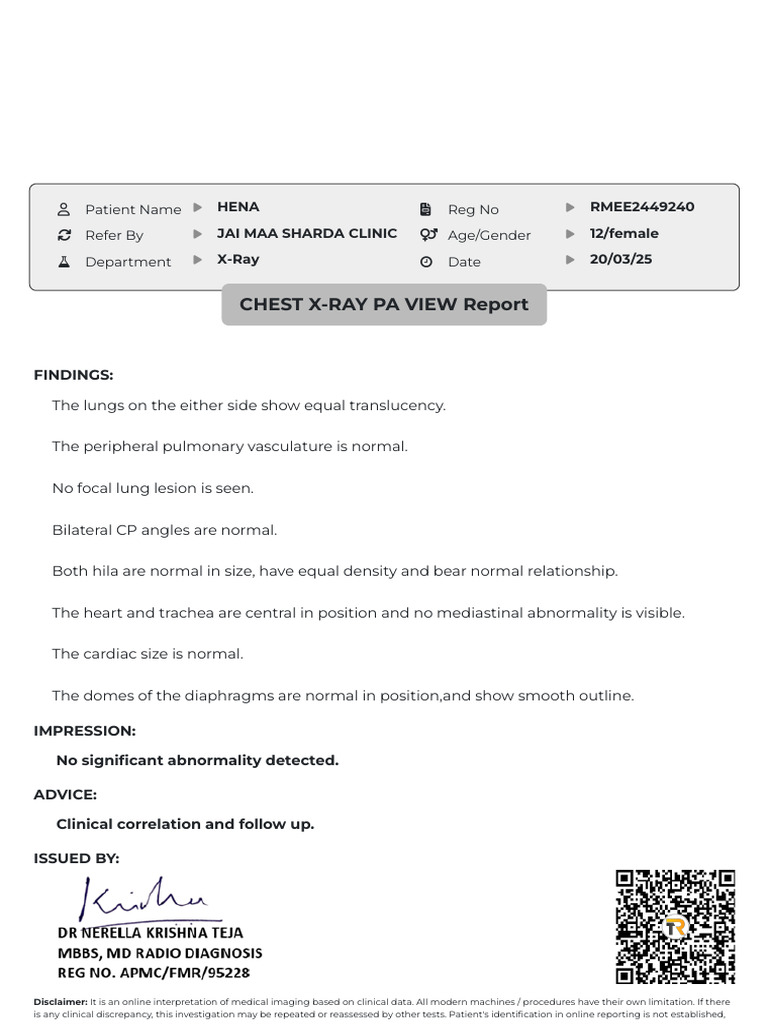 Chest X-Ray Report: No Abnormalities Found | PDF
