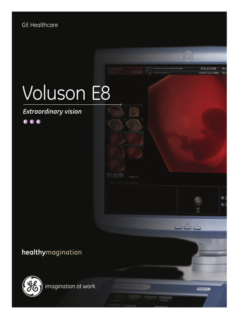 GE Voluson E8 BT13 Brochure | PDF | Medical Ultrasound | Medical Specialties