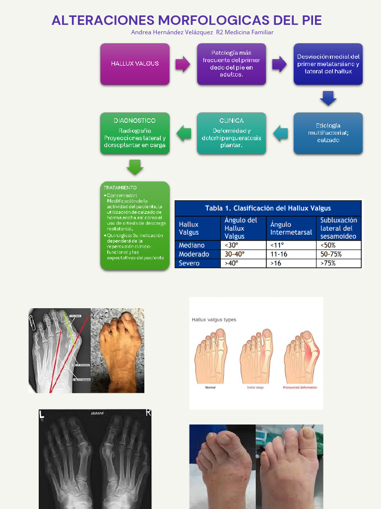 Alteraciones Morfologicas Del Pie - 20240920 - 152610 - 0000 | PDF
