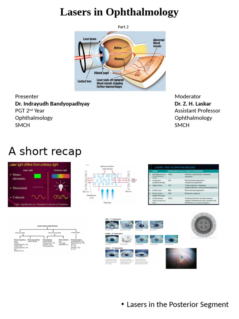 Lasers in Ophthalmology End v2.0 | PDF | Retina | Visual System