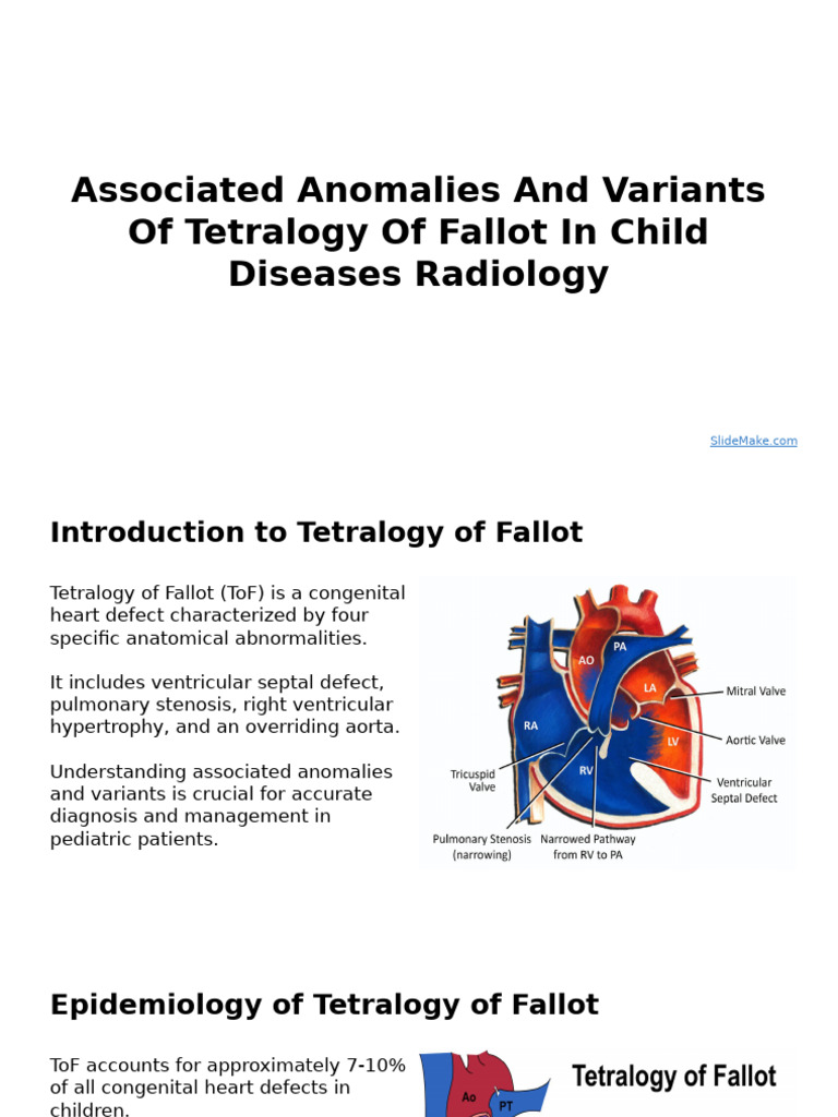 Associated Anomalies and Variants of Tetralogy of Fallot in Child ...