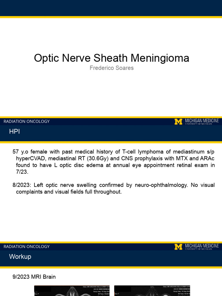 Optic Nerve Sheath Meningioma Overview | PDF | Radiation Therapy ...