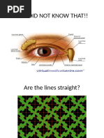 Grade 12 Life Science The Eye | PDF | Eye | Myopia