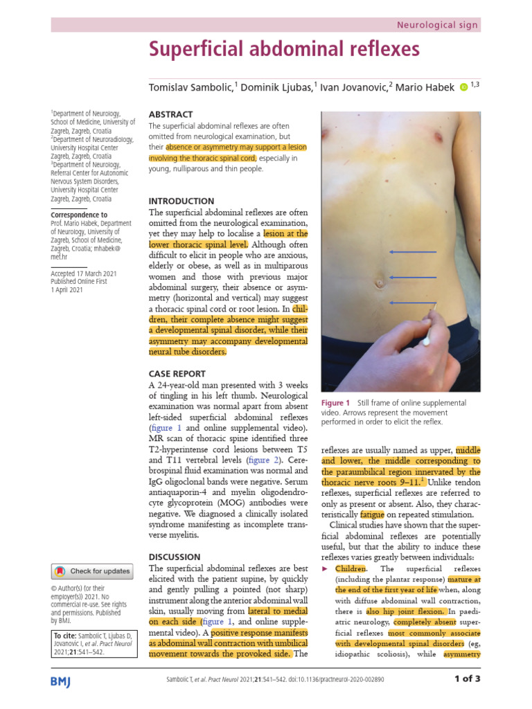 100 (RC-3+) Superficial Abdominal Reflexes | PDF | Neurology | Vertebral Column