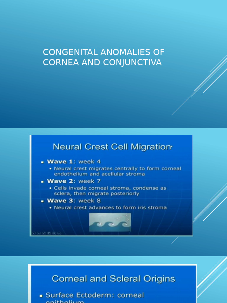 Anomalies of Cornea and Conjunctiva | PDF